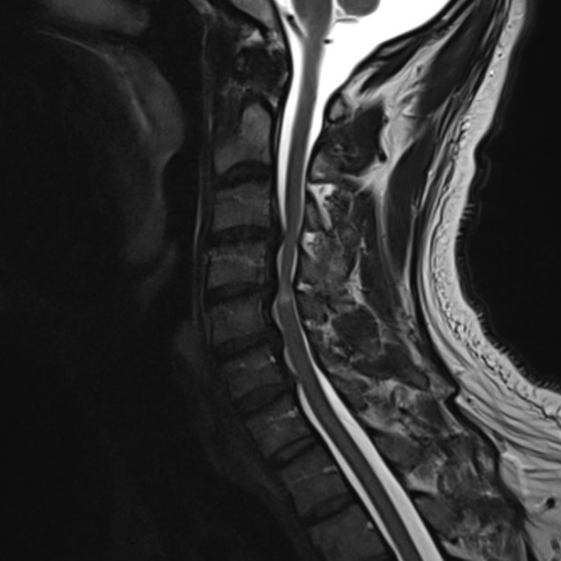 Rug & nek | Orthoclinic - Orthopedie Brugge