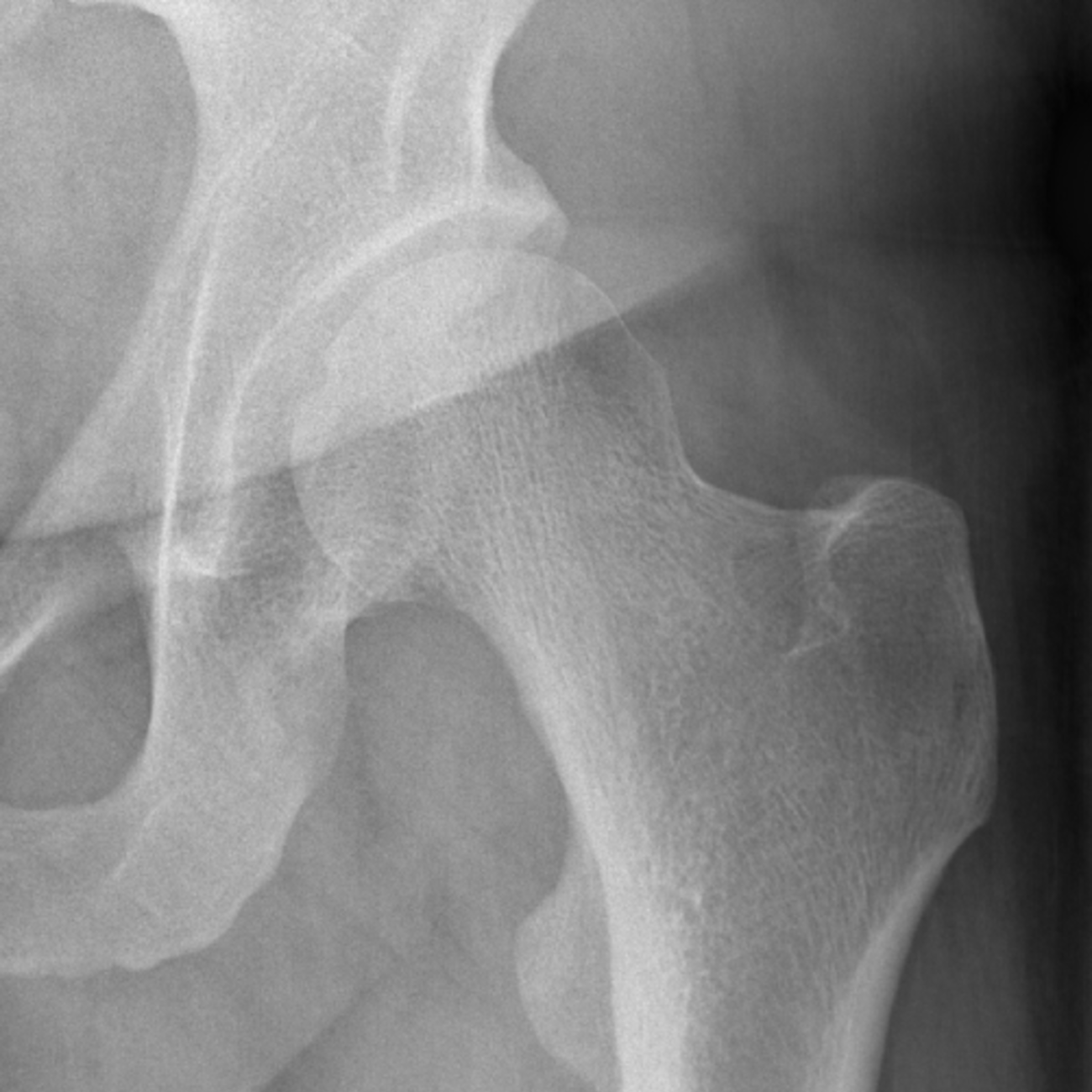 Heup | Orthoclinic - Orthopedie Brugge