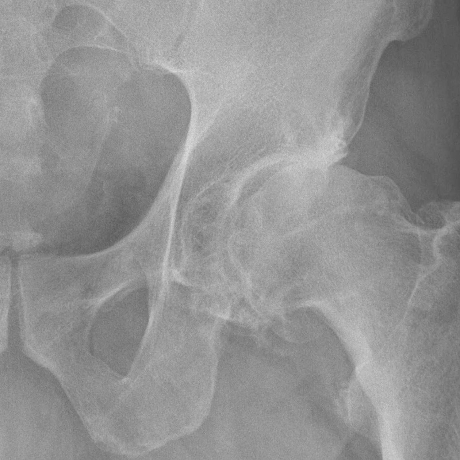 Heup | Orthoclinic - Orthopedie Brugge