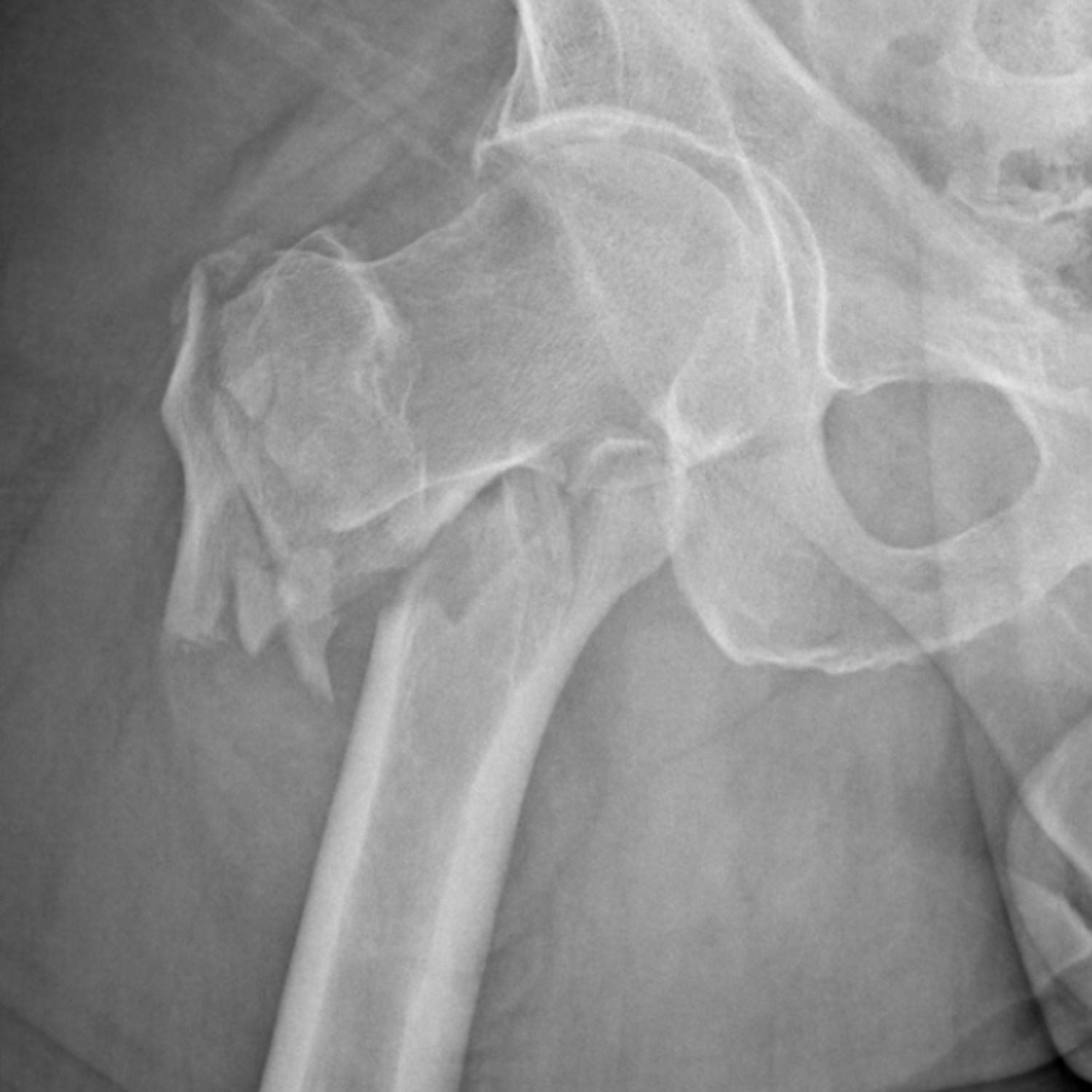 Heup | Orthoclinic - Orthopedie Brugge