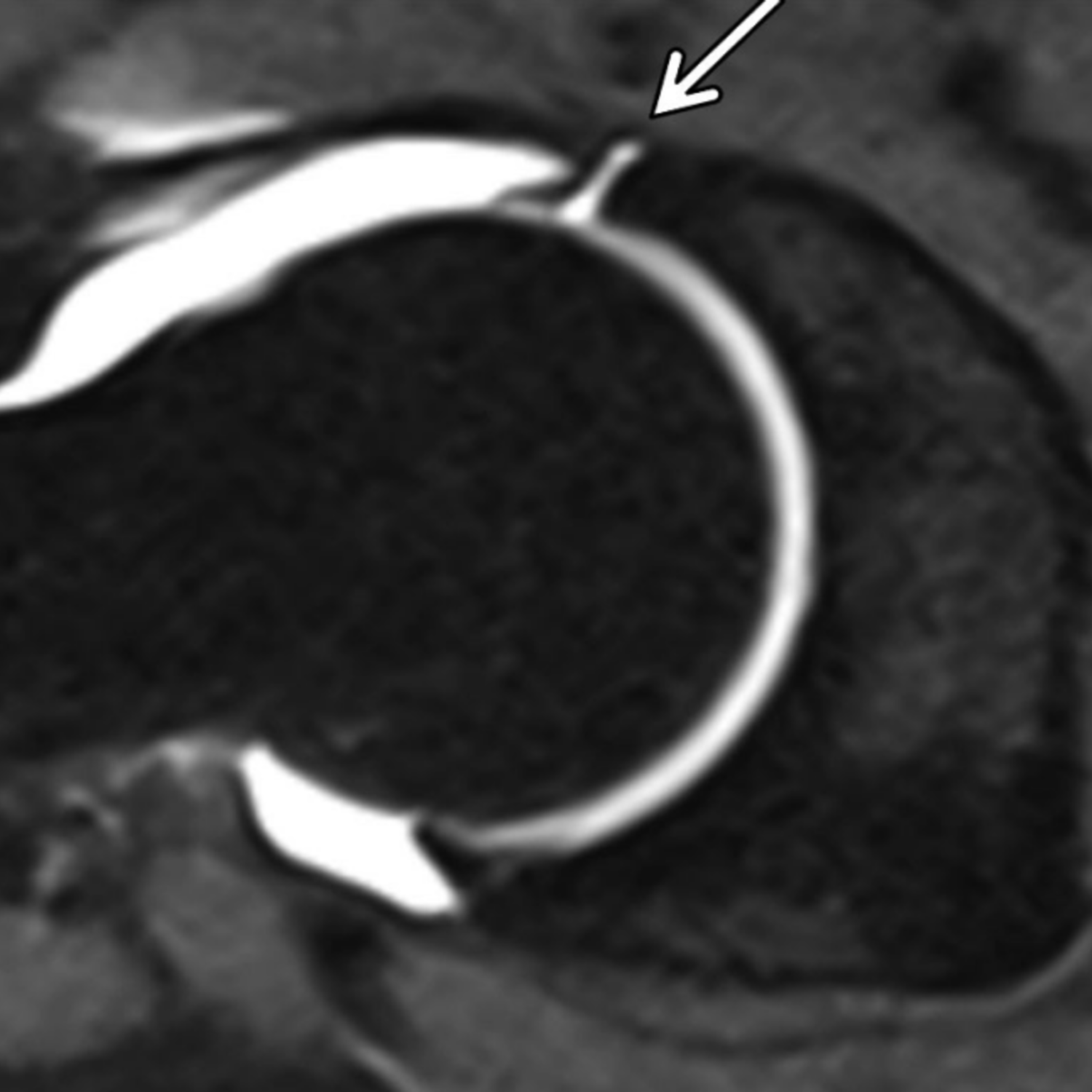Heup | Orthoclinic - Orthopedie Brugge