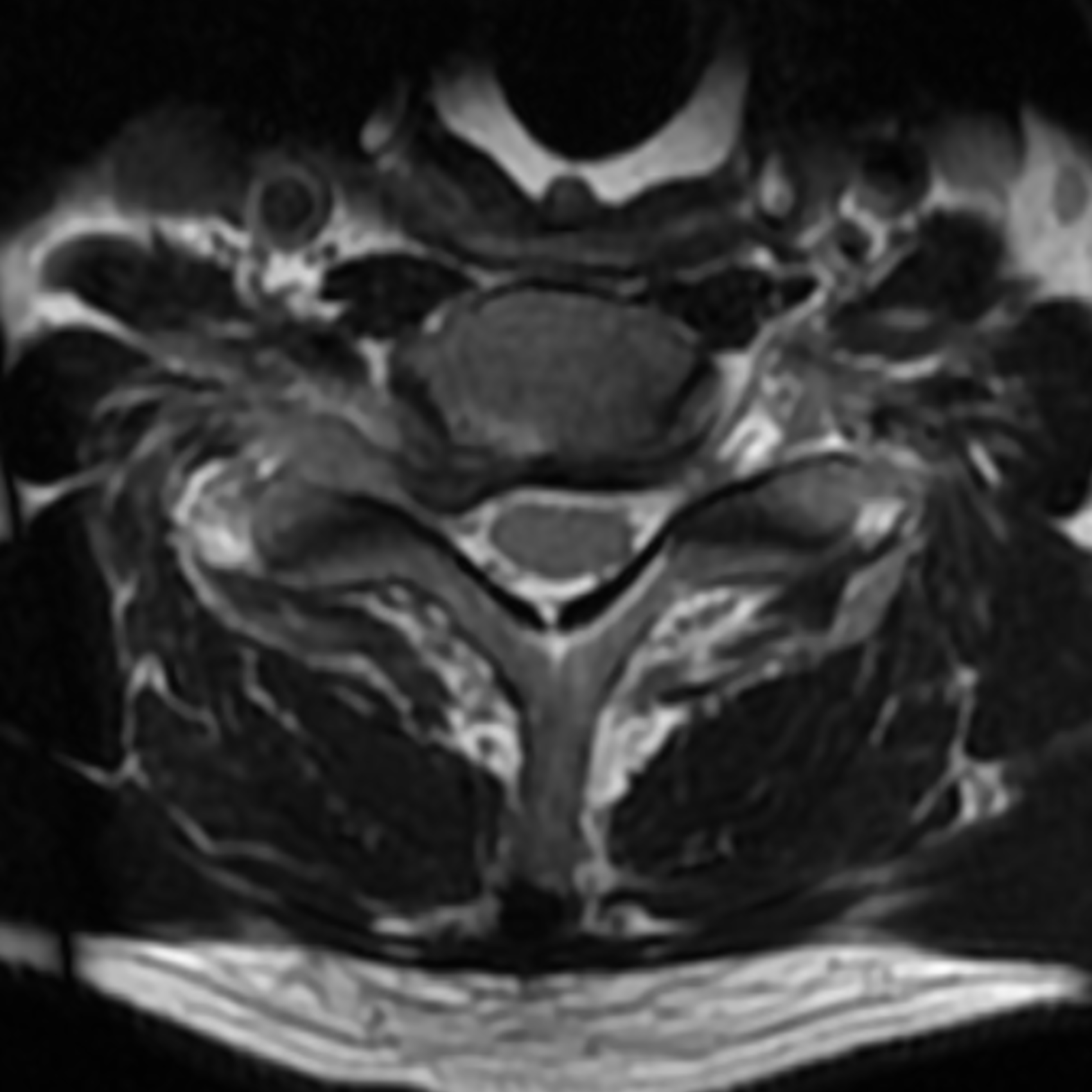 Rug & nek | Orthoclinic - Orthopedie Brugge