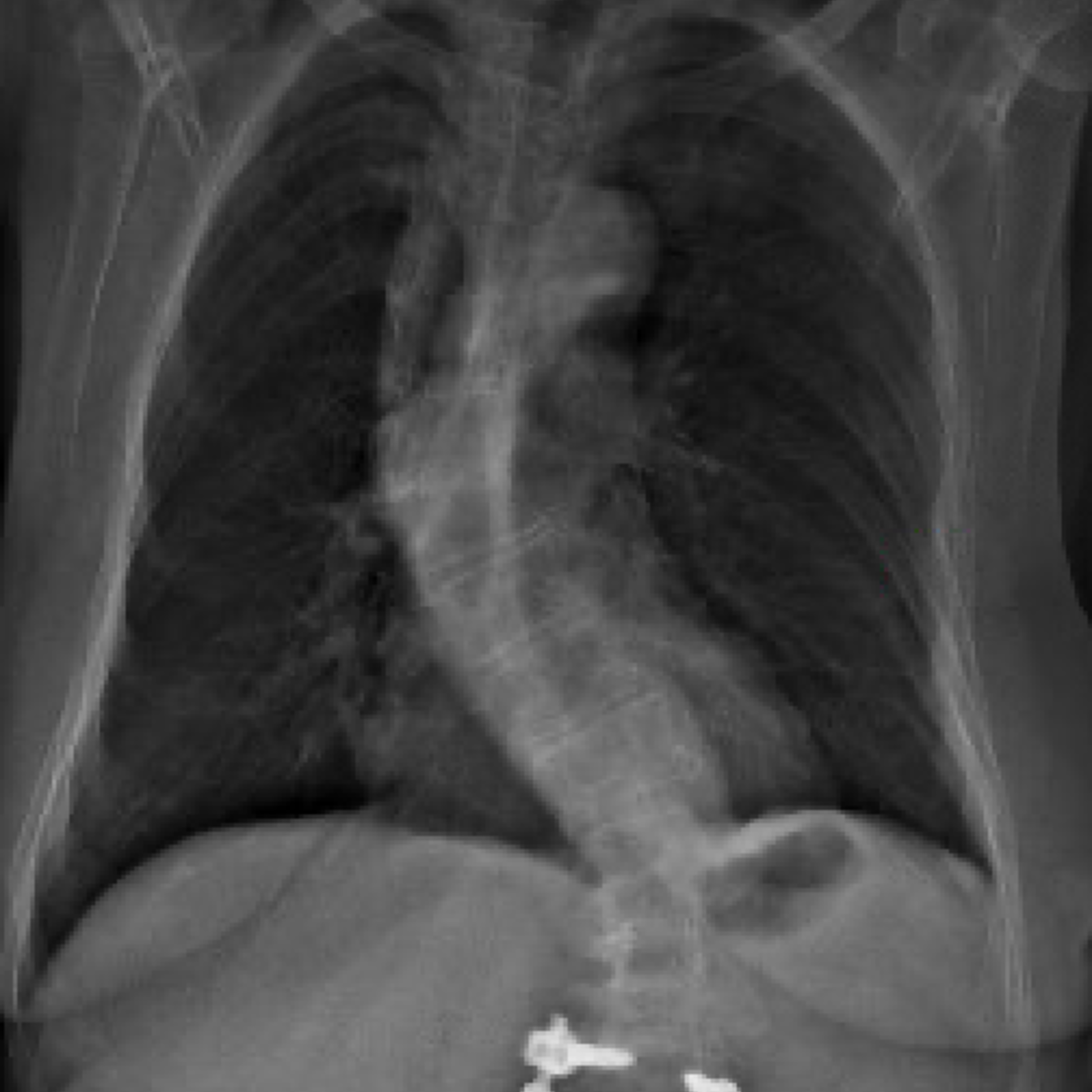 Rug & nek | Orthoclinic - Orthopedie Brugge