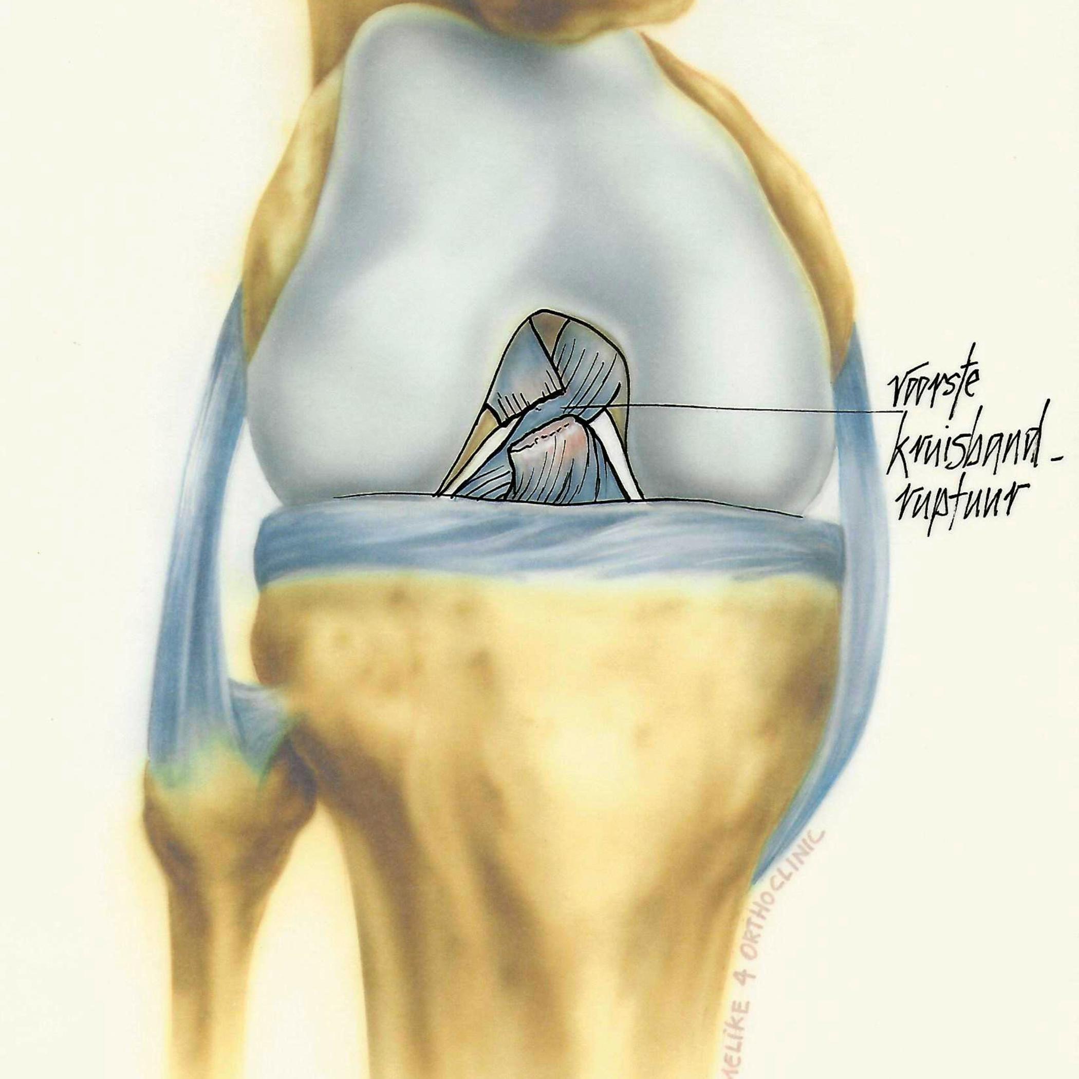 Knie | Orthoclinic - Orthopedie Brugge
