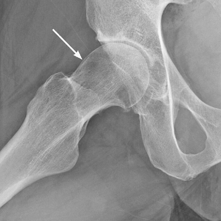 Heup | Orthoclinic - Orthopedie Brugge