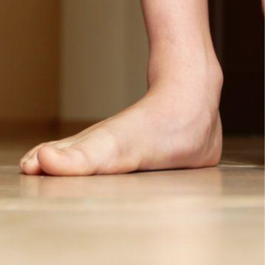 Voet & enkel | Orthoclinic - Orthopedie Brugge