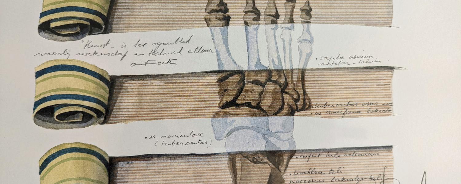 Morton's neurinoom | Orthoclinic - Orthopedie Brugge