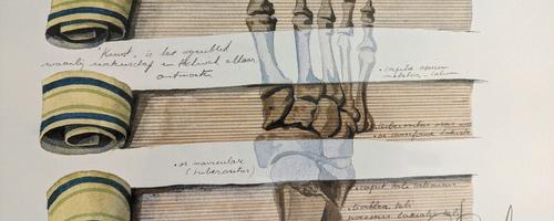 Morton's neurinoom | Orthoclinic - Orthopedie Brugge