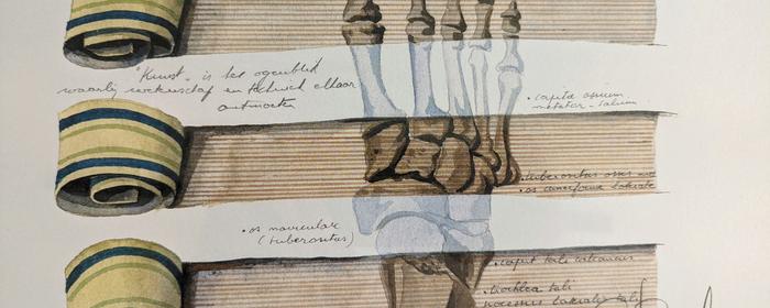 Morton's neurinoom | Orthoclinic - Orthopedie Brugge