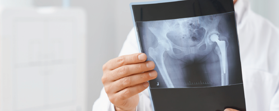 Totale heupprothese in het dagziekenhuis. | Orthoclinic - Orthopedie Brugge