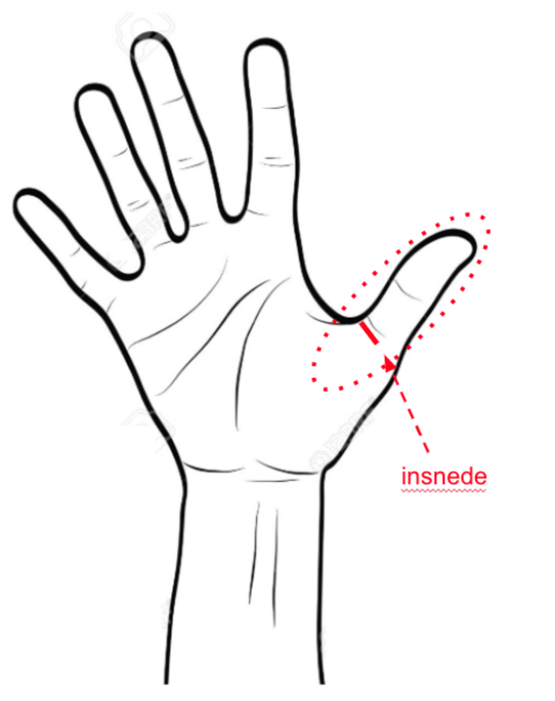 Springduim | Orthoclinic Brugge