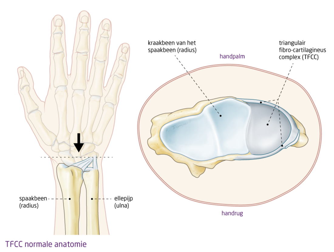 TFCC scheur | Orthoclinic Brugge