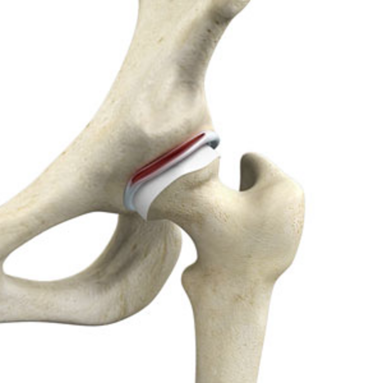 Labrumscheur | Orthoclinic - Orthopedie Brugge