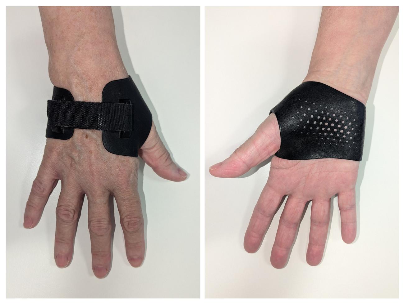 Duimbasis artrose | Orthoclinic Brugge