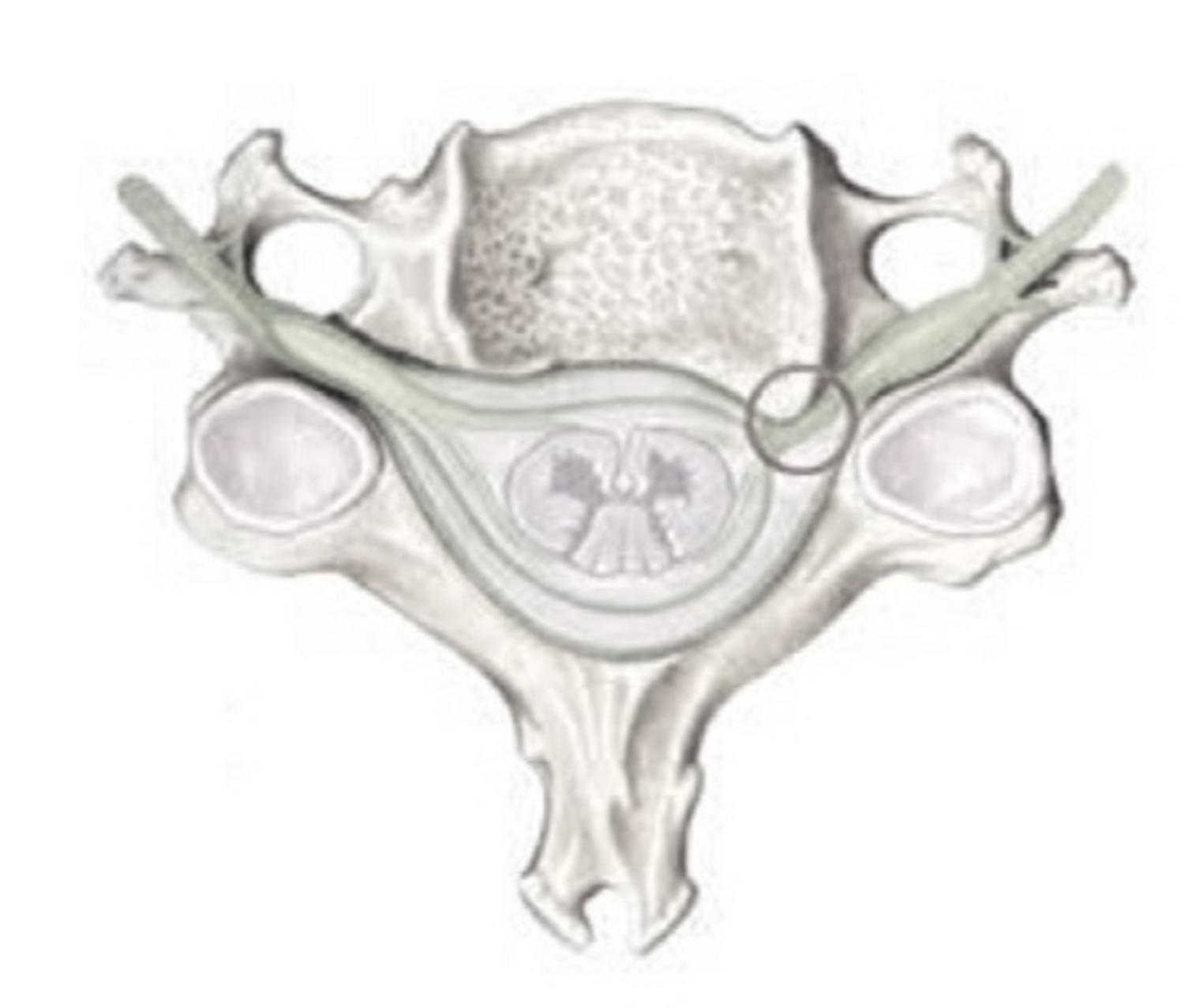 Discus hernia (nek) | Orthoclinic Brugge