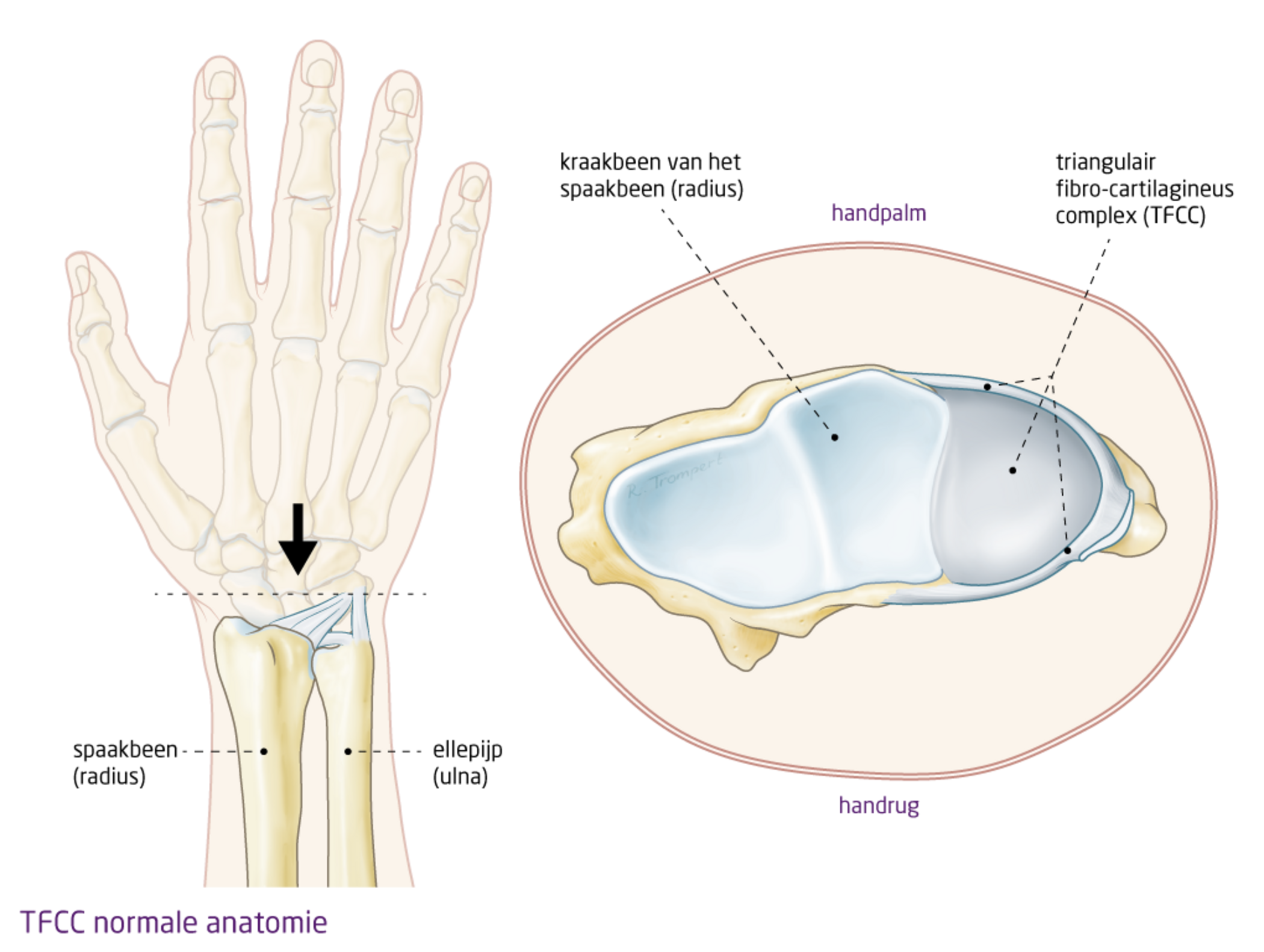 TFCC scheur | Orthoclinic Brugge