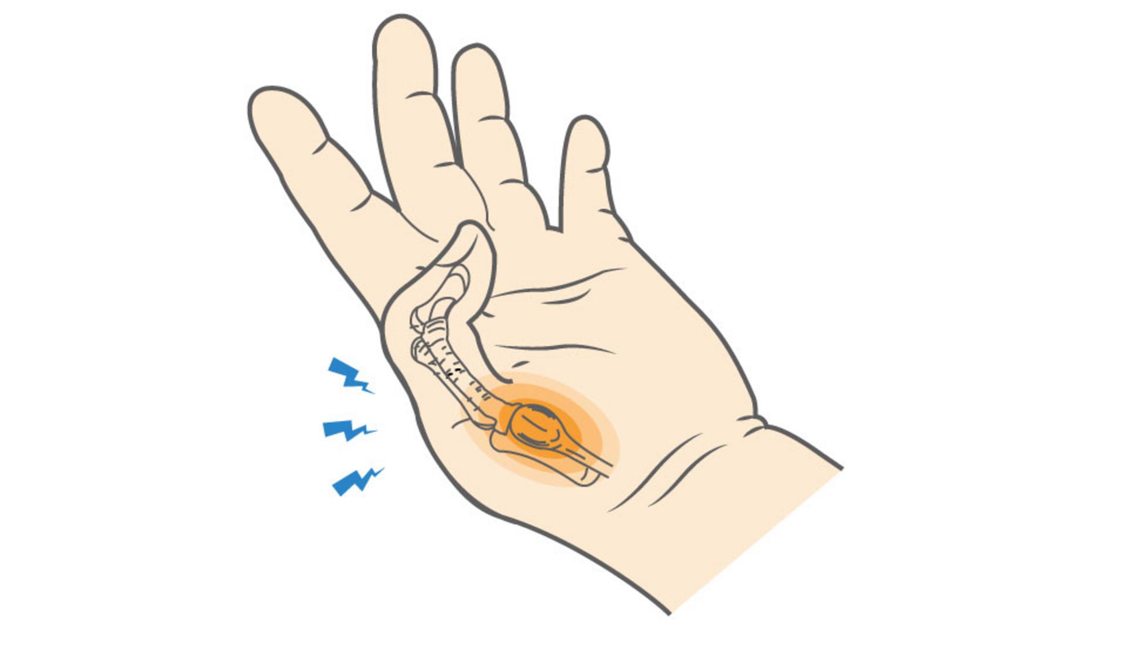 Springduim | Orthoclinic Brugge