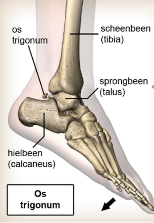 Posterieur enkelimpingement | Orthoclinic Brugge
