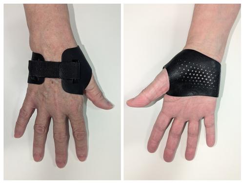 Duimbasis artrose | Orthoclinic Brugge