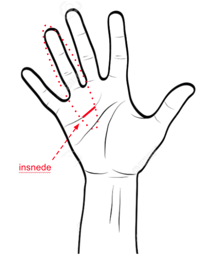 Springvinger | Orthoclinic Brugge