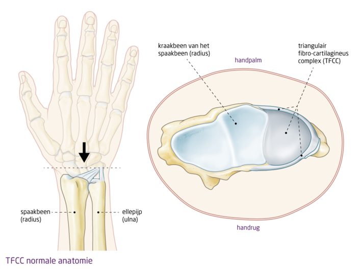 TFCC scheur | Orthoclinic Brugge
